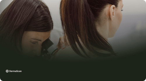 DermaScan | Découvrez la méthode ABCDE